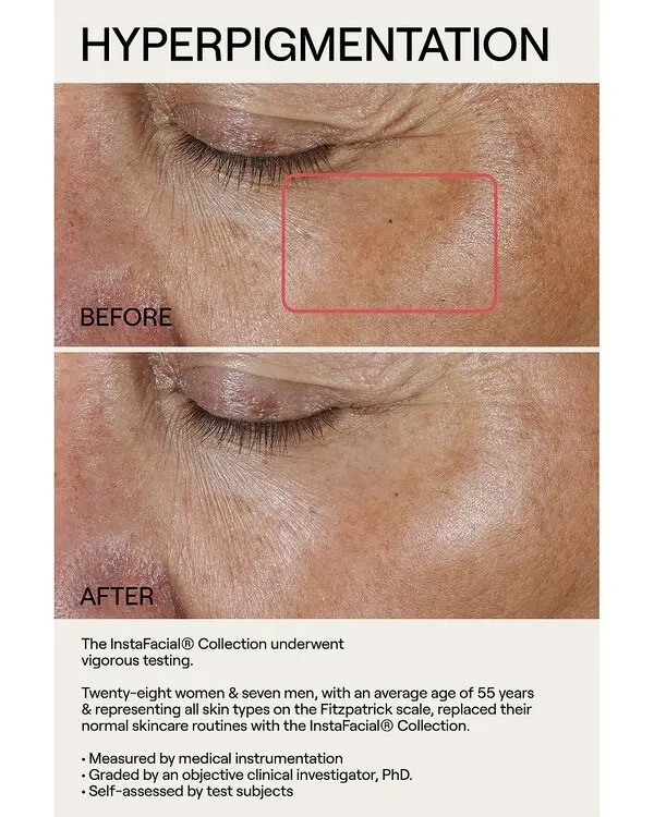 DR. DIAMOND'S METACINE Nstafacial Collection Plasma &#54168;&#51060;&#49828; &#49464;&#47100