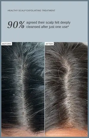 ALPHA-H Healthy Exfoliating Scalp Treatment