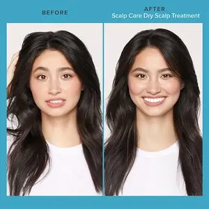 Living Proof Scalp Care Dry Scalp Treatment - Na