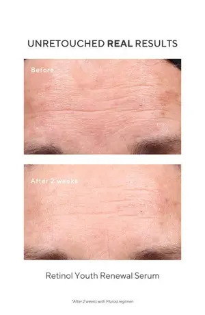 MURAD Retinol Youth Renewal Serum - No Color