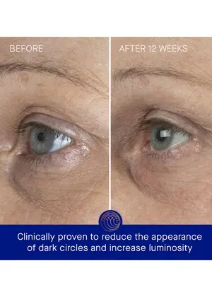Augustinus Bader The Eye Cream Lotions, Increase Skin Firmness, Eye Treatments