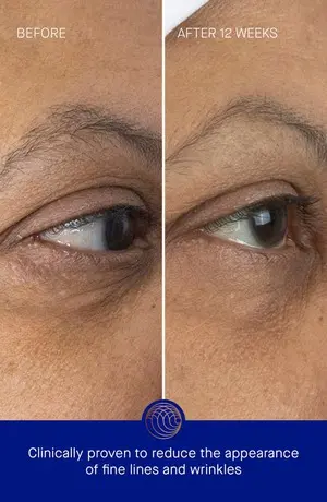 Augustinus Bader The Eye Cream - Eco Refill