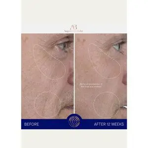 Augustinus Bader The Serum Refill, 1 Oz - Noclr
