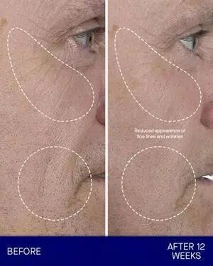 Augustinus Bader The Serum Refill, 1 Oz - Noclr