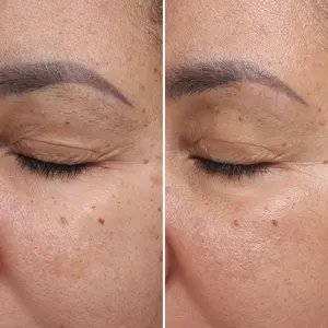 COLORESCIENCE Total Eye 3-in-1 Renewal Spf 35