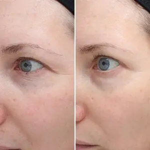 COLORESCIENCE Total Eye 3-in-1 Renewal Spf 35