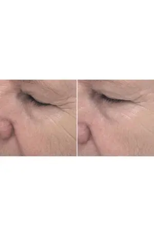 PCA SKIN Exlinea Peptide Smoothing Serum