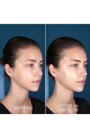 LANCOME Advanced Génifique Hydrogel Melting Sheet Mask