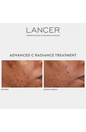 LANCER SKINCARE Advanced C Radiance Cream