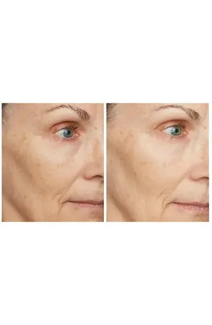 LANCER SKINCARE The Method: Cleanse For Normal To Combination Skin - No Color
