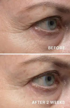 Elemis Pro-collagen Eye Revive Mask - No Color