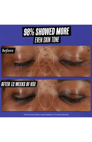 KIEHL'S SINCE 1851 Clearly Corrective™ Dark Spot Solution Face Serum - No Color