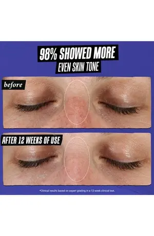 KIEHL'S SINCE 1851 Clearly Corrective™ Dark Spot Solution Face Serum - No Color