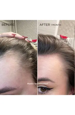 PHYTO Cyane Revitalizing Scalp Serum For Temporary Hair Thinning