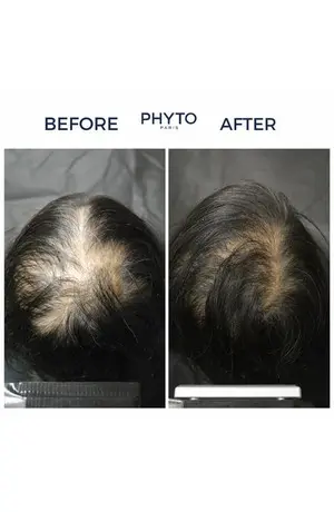 PHYTO Cyane Revitalizing Scalp Serum For Temporary Hair Thinning