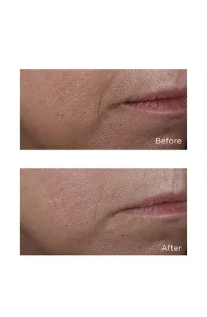 PERRICONE MD Cold Plasma Plus+ Advanced Serum Concentrate - No Color