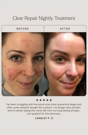 True Botanicals Clear Repair Serum