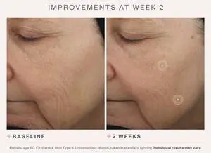 Skinmedica Tns Advanced+ Anti-aging Serum