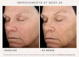 Skinmedica Tns Advanced+ Anti-aging Serum