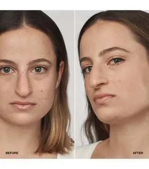 CLINIQUE Even Better Clinical Serum Foundation Spf 20 - Nude
