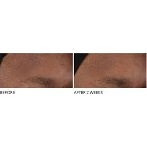 DR. DENNIS GROSS SKINCARE Advanced Retinol + Ferulic Overnight Wrinkle Treatment