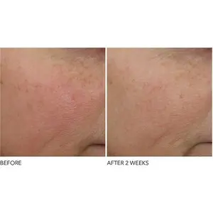 DR. DENNIS GROSS SKINCARE Advanced Retinol + Ferulic Overnight Wrinkle Treatment
