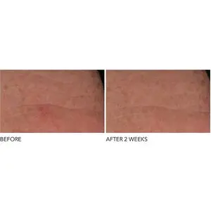 DR. DENNIS GROSS SKINCARE Advanced Retinol + Ferulic Overnight Wrinkle Treatment