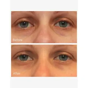 MURAD Vita-c Eyes Dark Circle Corrector 15ml - Na