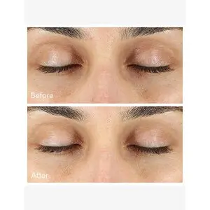 MURAD Vita-c Eyes Dark Circle Corrector 15ml - Na