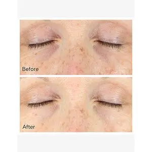 MURAD Vita-c Eyes Dark Circle Corrector 15ml - Na