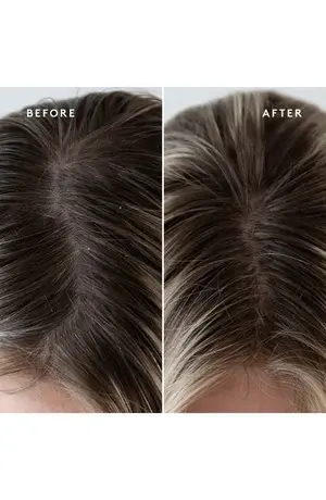 Virtue® Exfoliating Scalp Treatment