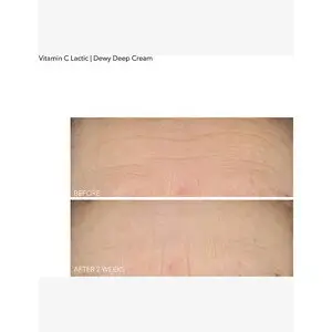 DR. DENNIS GROSS SKINCARE Vitamin C Lactic Dewy Deep Cream