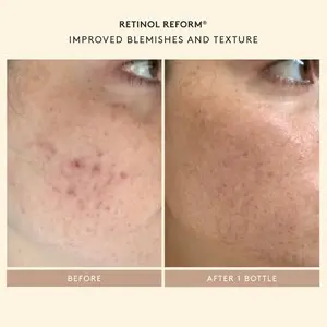 SHANI DARDEN SKIN CARE The Ultimate Glow Kit