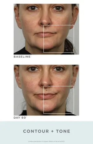 NUFACE® Trinity Facial Toning Device