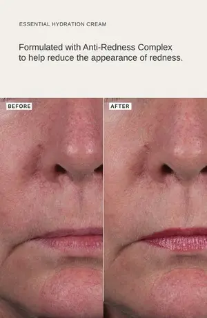 ALPHA-H Essential Hydration Cream With Rose Geranium - None