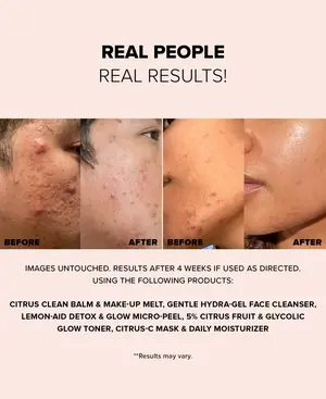 NUDESTIX Nudeskin 5% Citrus Fruit & Glycolic Glow Toner - No Color