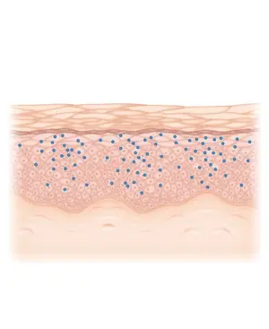 SOLARIS LABORATORIES NY Time Off Dissolving Hyaluronic Acid Microneedle Overnight Patch Treatment