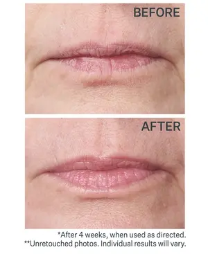 Strivectin Double Fix For Lips Plumping & Vertical Line Treatment - N,a