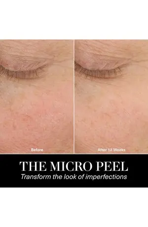 La Mer The Resurfacing Micro Peel Treatment For Anti-aging - No Color