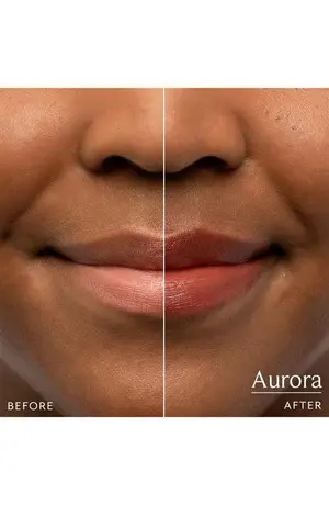 FRESH® Sugar Lip Treatment - Aurora Red