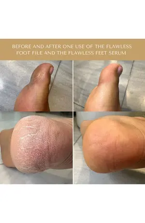 SERUM DOCTOR Flawless Feet System
