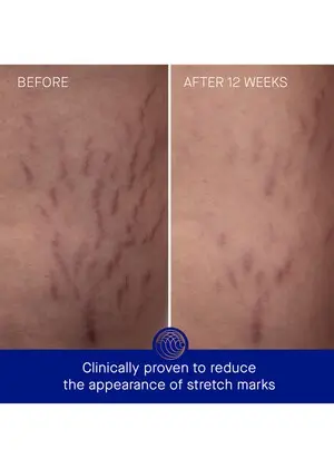 Augustinus Bader The Body Vegan Moisturiser Complex Of Natural Amino Acids - Cream