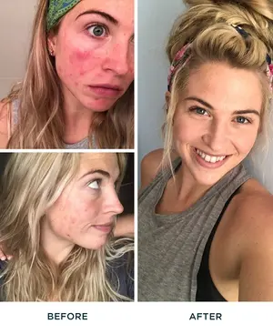 FRE Detox Me Clearing Mask