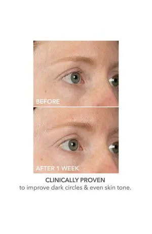 DR. DENNIS GROSS SKINCARE Derminfusions Lift + Repair Eye Mask