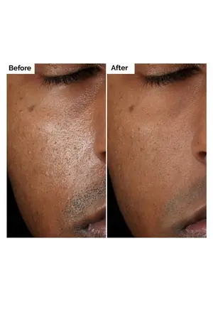 THE ORDINARY Aloe 2% + Nag 2% Solution For Post-acne Marks - No Color