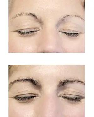 NeuLASH® Neubrow Brow Enhancing Serum