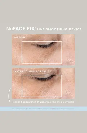 NuFACE Fix Line Smoothing Device & Serum Set $165 Value