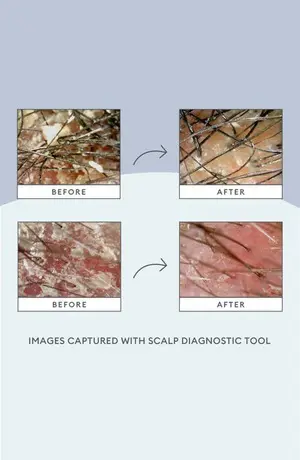 BRIOGEO Scalp Saviors Set $60 Value