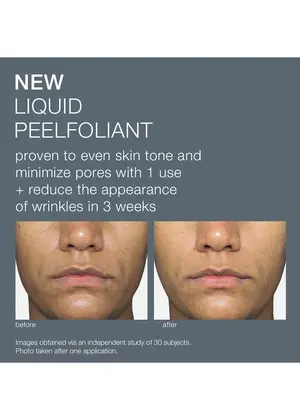 DERMALOGICA Liquid Peelfoliant - Na