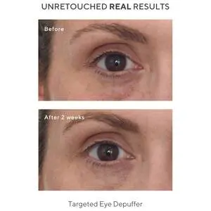 MURAD Targeted Eye Depuffer 0.5 Oz